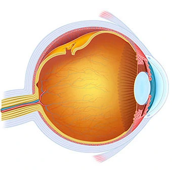 Retina Disease Treatment in Hyderabad | Retina Treatment in Kukatpally ...